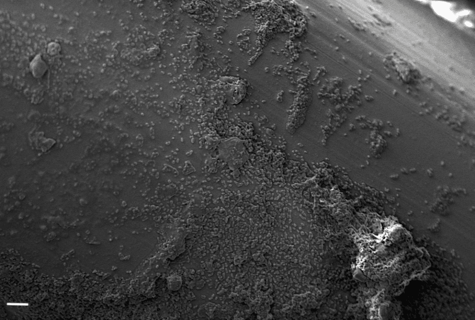 Biofilm Image Gallery - NBIC
