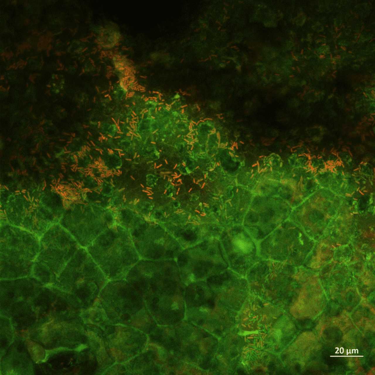 Biofilm Image Gallery - NBIC