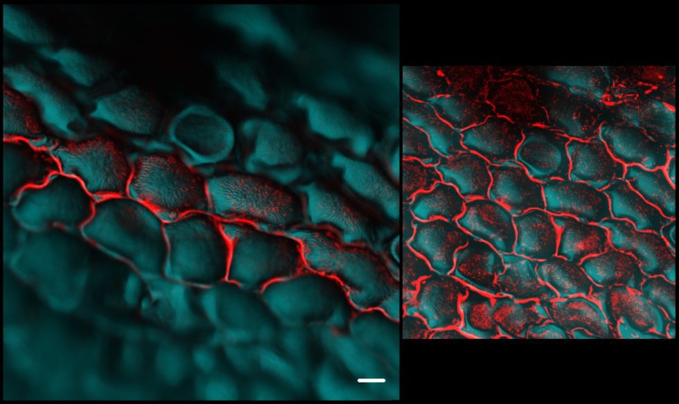 Biofilm Image Gallery - NBIC