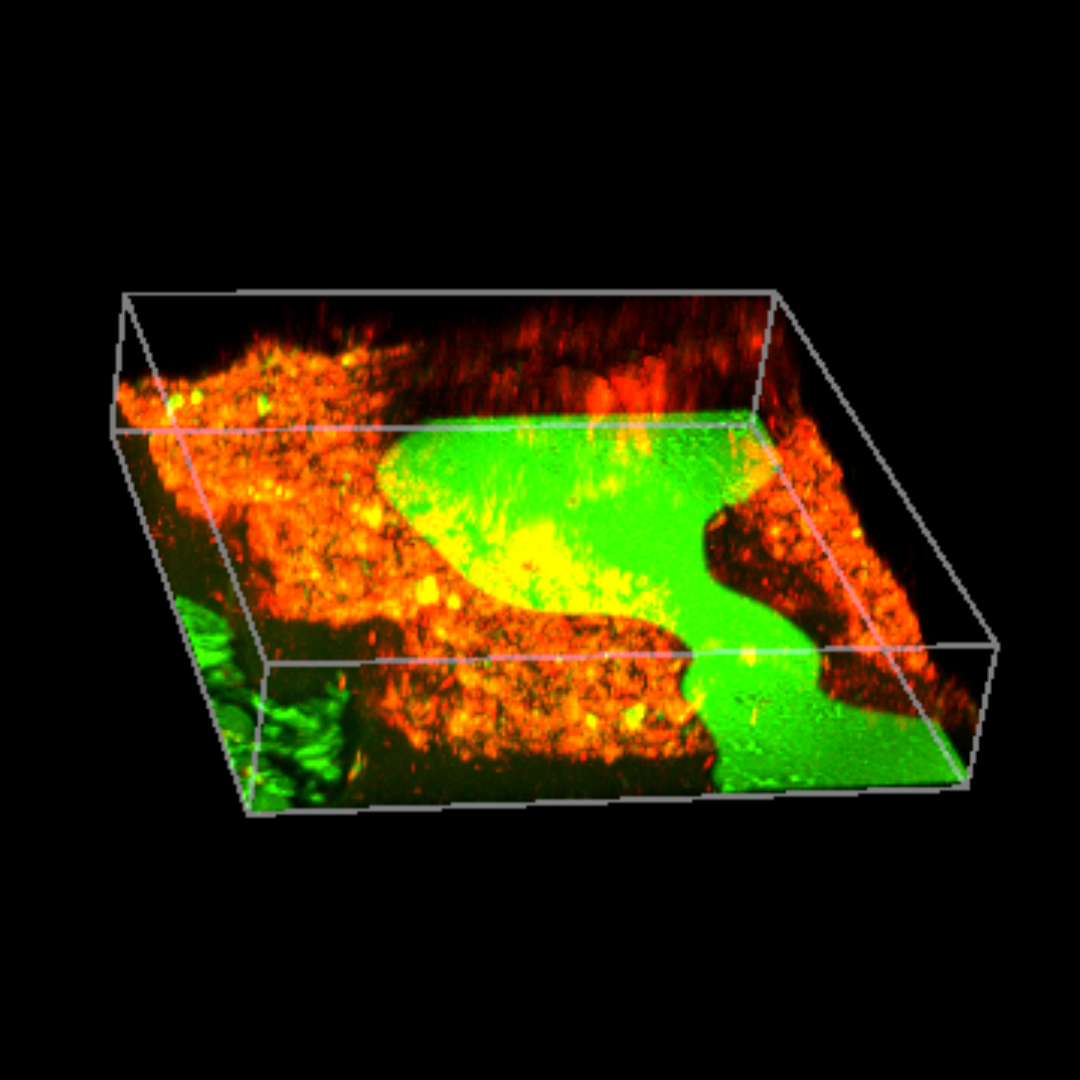 Using Chewing Gum to Improve Oral Health - Beyond the Biofilm