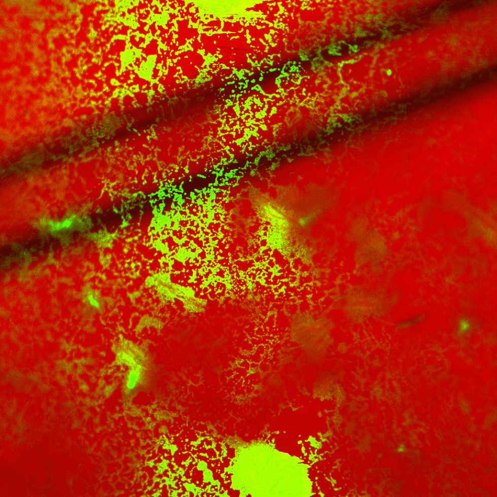 Biofilm Image Gallery - NBIC