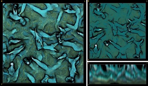 Biofilm Image Gallery - NBIC